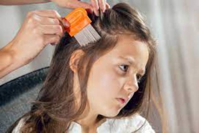 Does Head Lice Stay Alive on Pillows and Sheets?
